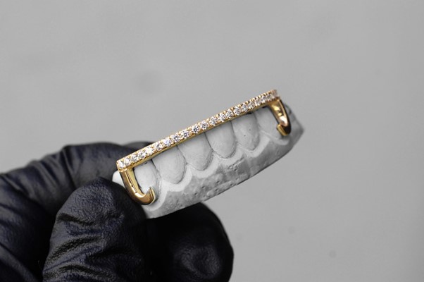 Custom Diamond Grillz Collection – Explore Teeth Grillz Designs